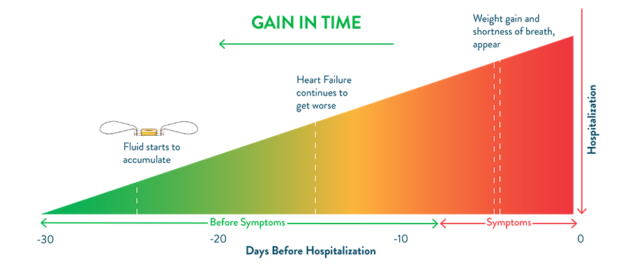 The CardioMEMS HF System Patient Conversation | Abbott