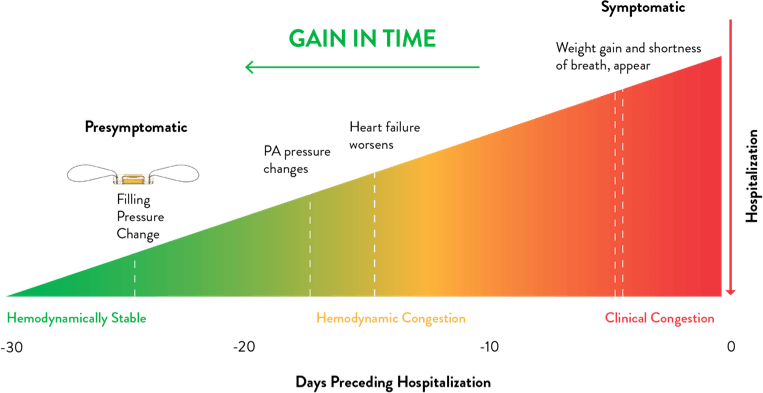 The CardioMEMS HF System Patient Conversation | Abbott