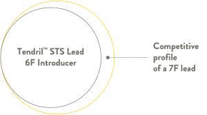 About Tendril Pacing Leads | Abbott