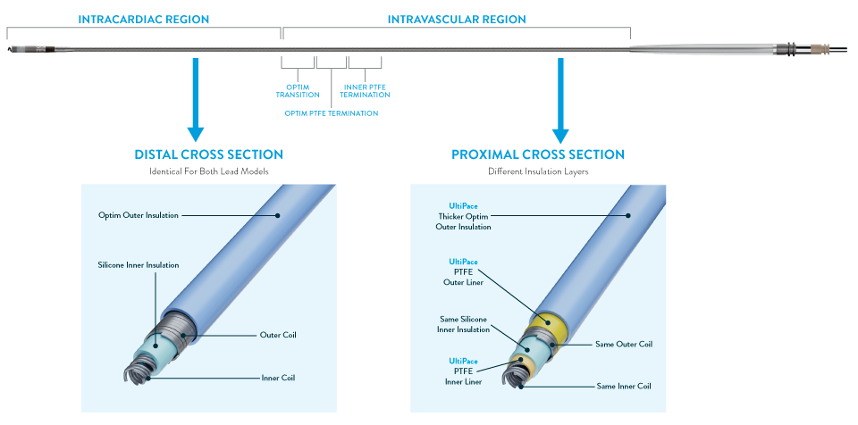 About UltiPace | Abbott