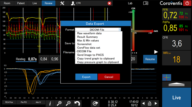 機能について | CoroFlow‡ Cardiovascular System | 冠内圧測定システム | アボットメディカルジャパン合同会社