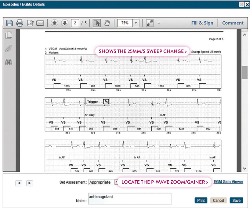 Data Management with the Confirm Rx ICM | Abbott
