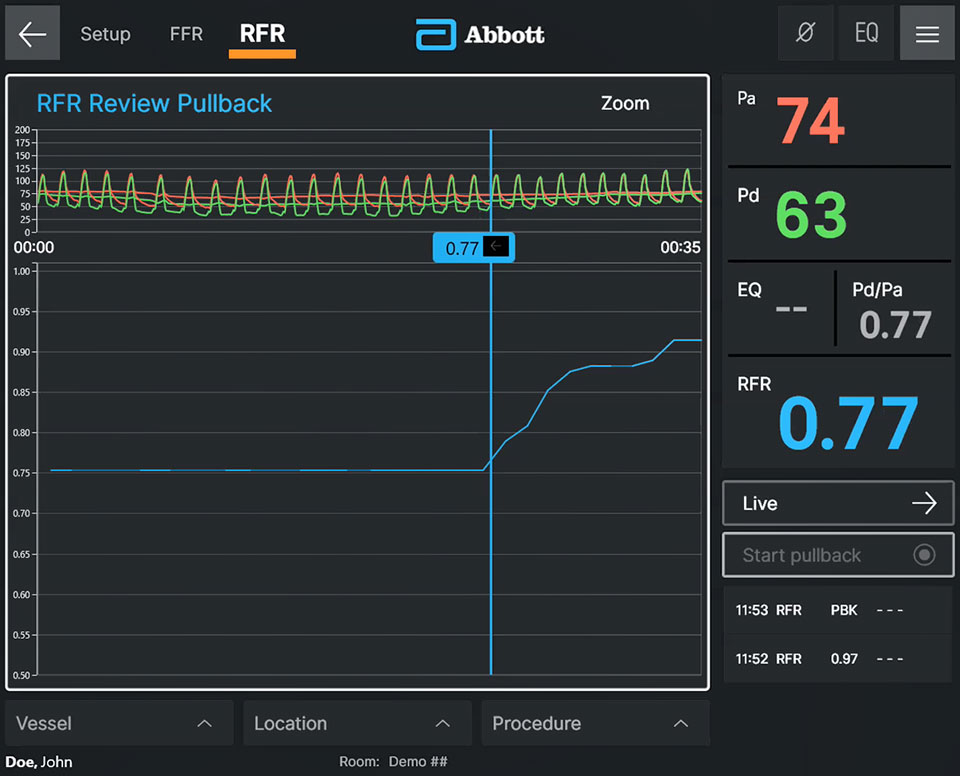 Abbott Ultreon Software for Physiology Assessment - PCI | Abbott
