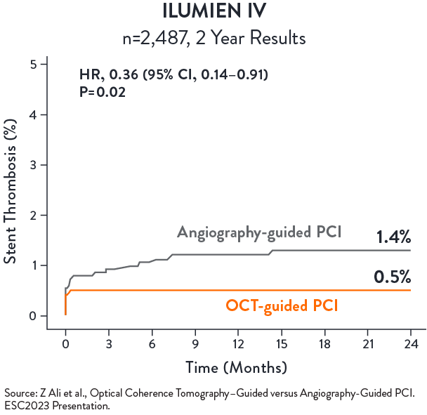 OCT vs Angiography | Abbott